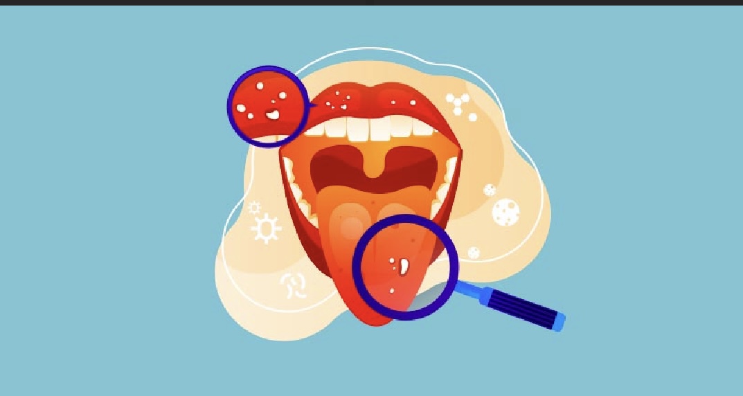 Colors of the tongue: 5 colors, 5 things they tell us Nmami Life